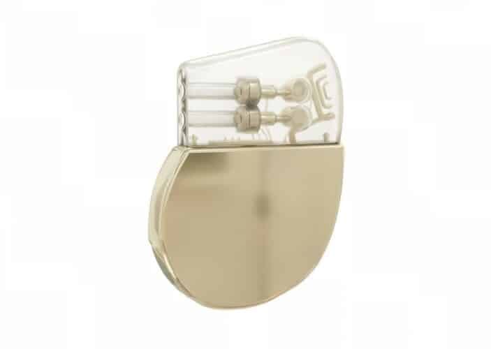 Entenda O Marcapasso: Guia Definitivo Sobre O Dispositivo Que Regula Os ...