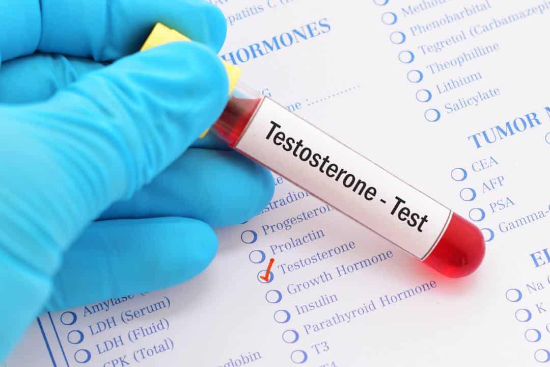 Testosterona - O Hormônio Anabolizante, Funções E Riscos De Uso