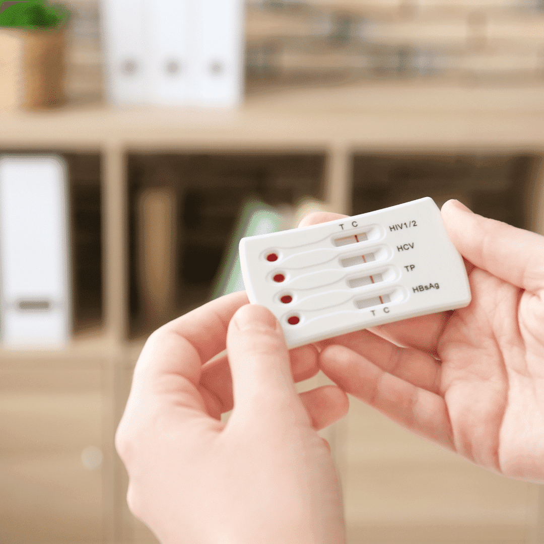 Exame VDRL: O Que é E Para Que Serve Portal Medicina Ribeirão